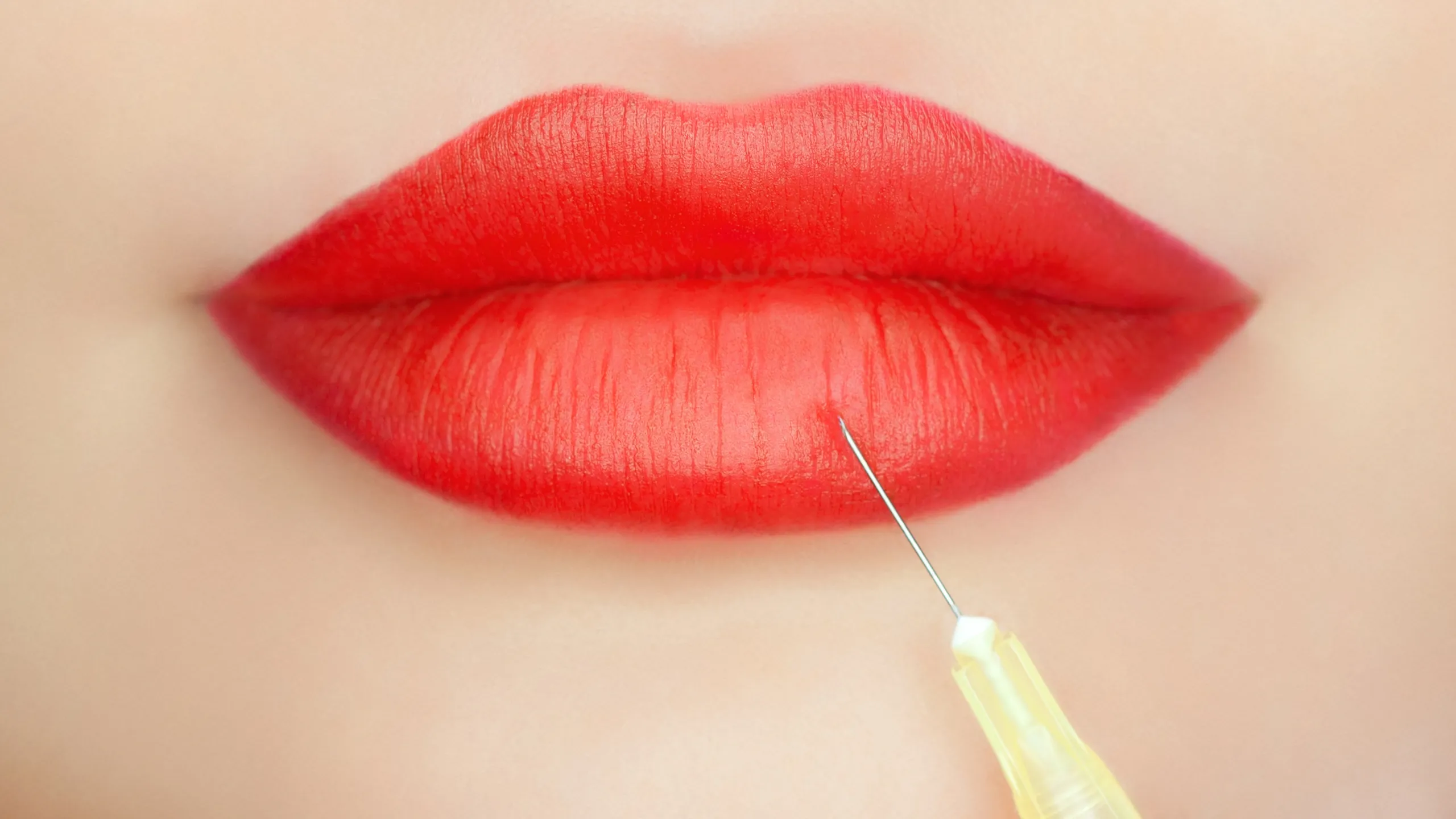 Lip Augmentation: Exploring the World of Lip Fillers - Reviews ...